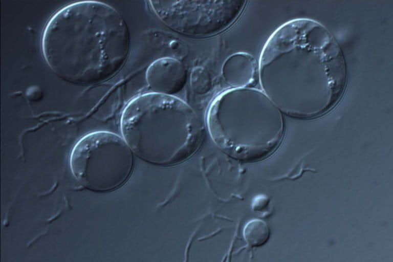 Rapid genetic test traces spread of fungus that kills frogs, reveals ...