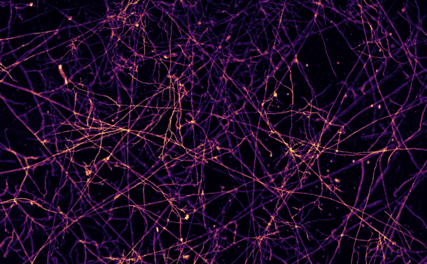 Scientists on a quest to map worldwide web of fungi beneath our feet